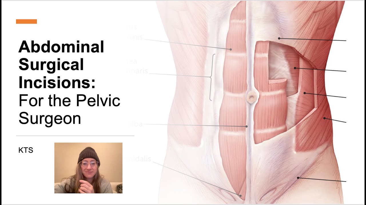 Abdominal surgical incisions and anatomy