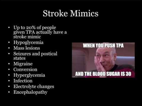 Stroke Mimics and TPA
