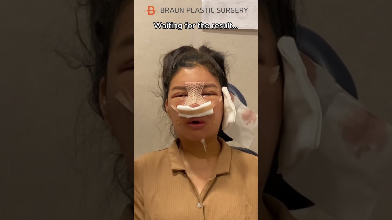 I cried when watching this...😭 #fyp #glowup #facialcontouringsurgery #rhinoplasty #plasticsurgery