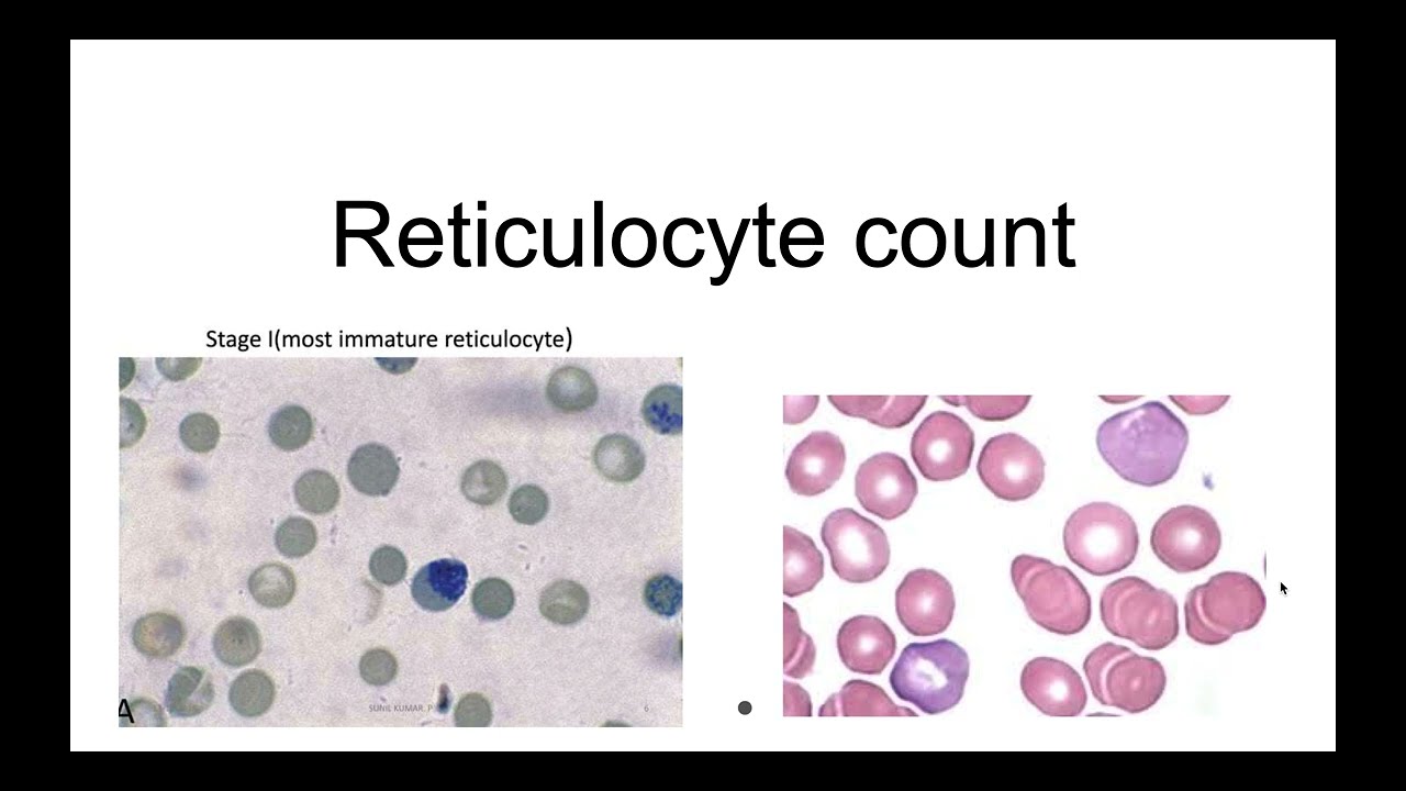 Reticulocyte Count