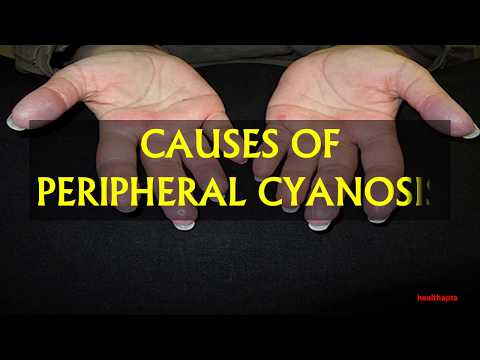 CAUSES OF PERIPHERAL CYANOSIS
