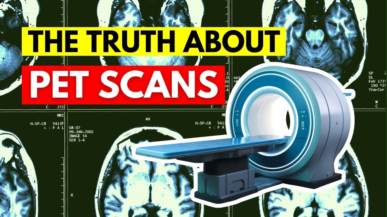 What PET Scans Can and Can’t Tell You About Cancer