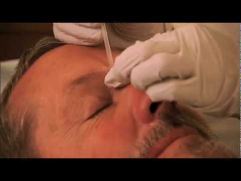 Acupuncture and Electroacupuncture