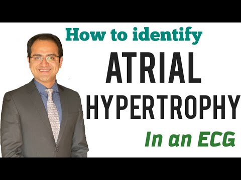Atrial Hypertrophy (Right & Left) ECG Interpretation Made Easy, ECG Lectures USMLE, Neet Pg