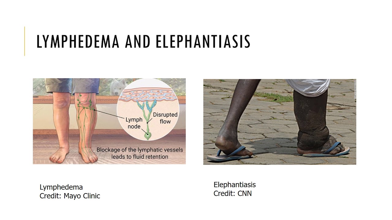 Chapter 21 Recorded Lecture