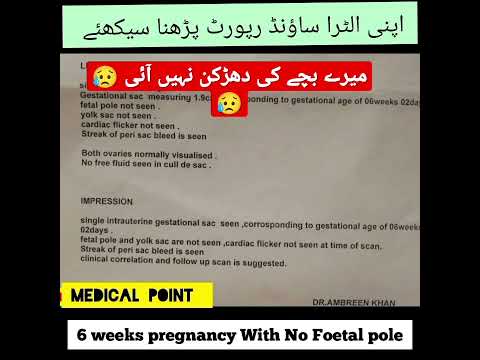 Early Pregnancy with no foetal pole😥😥 #pregnancy #viral #earlypregnancy #medical #ultrasoundreport