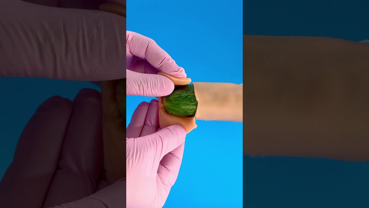 What REALLY Happens During Circumcision