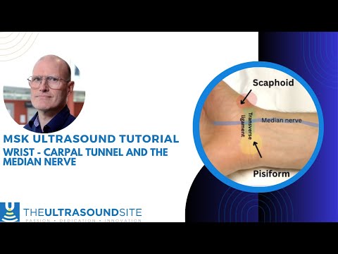#carpaltunnel - step-by-step how to find it on ultrasound!