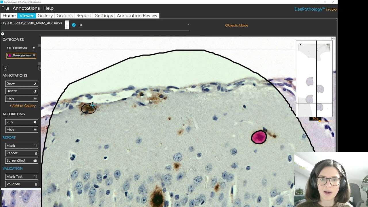 DeePathology™ STUDIO web - Deepathology