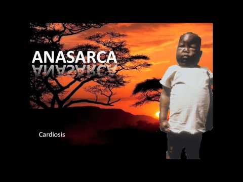 Anasarca - The 4 Causes