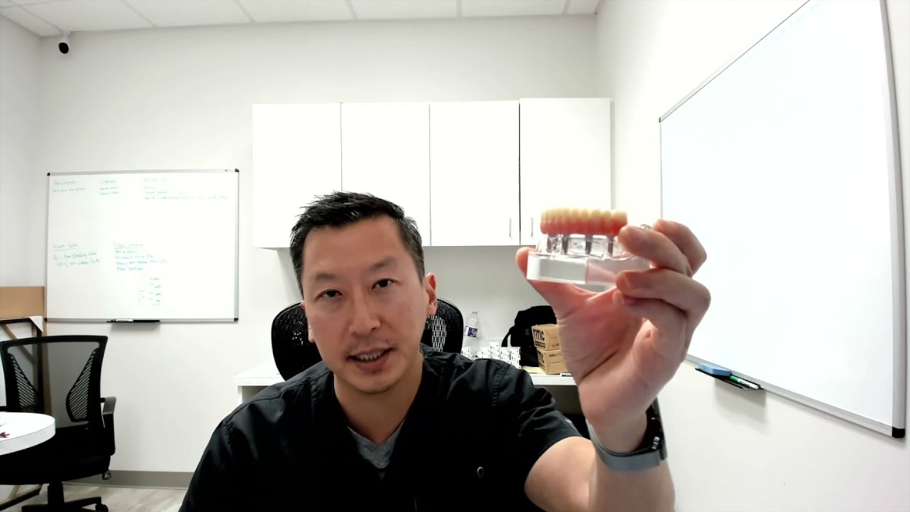 Zirconia vs. PMMA: The Ultimate Guide to Choosing Your All-on-Four Prosthesis