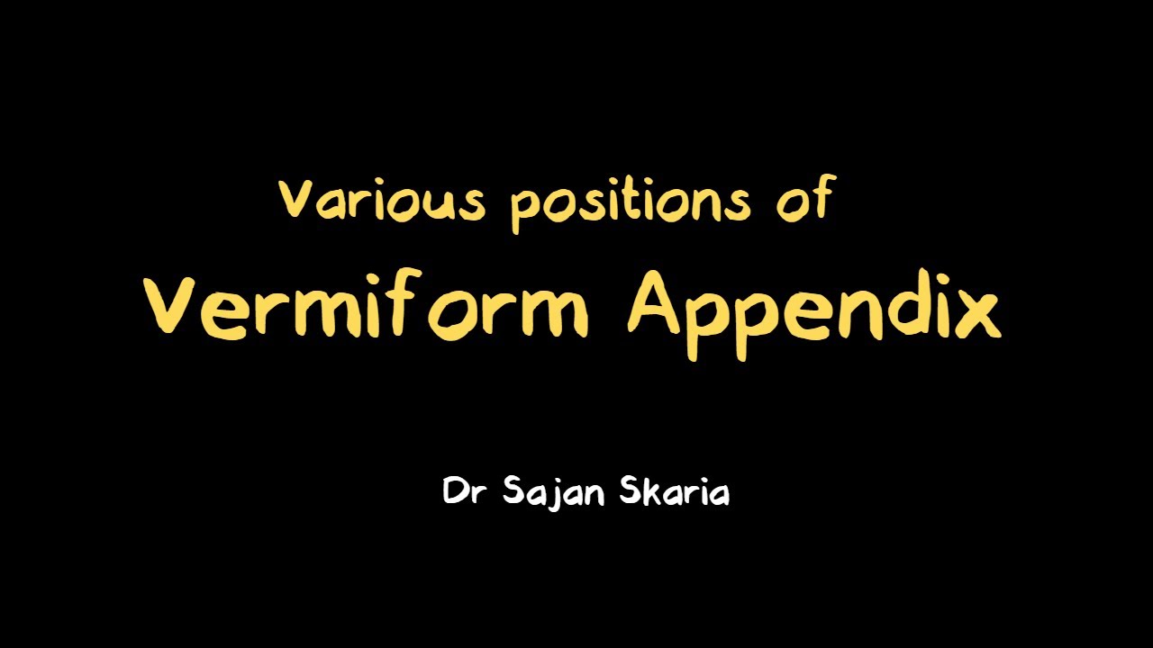 VARIOUS POSITIONS OF VERMIFORM APPENDIX