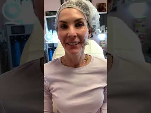 PDO Threads @ Your Best You Medical Spa
