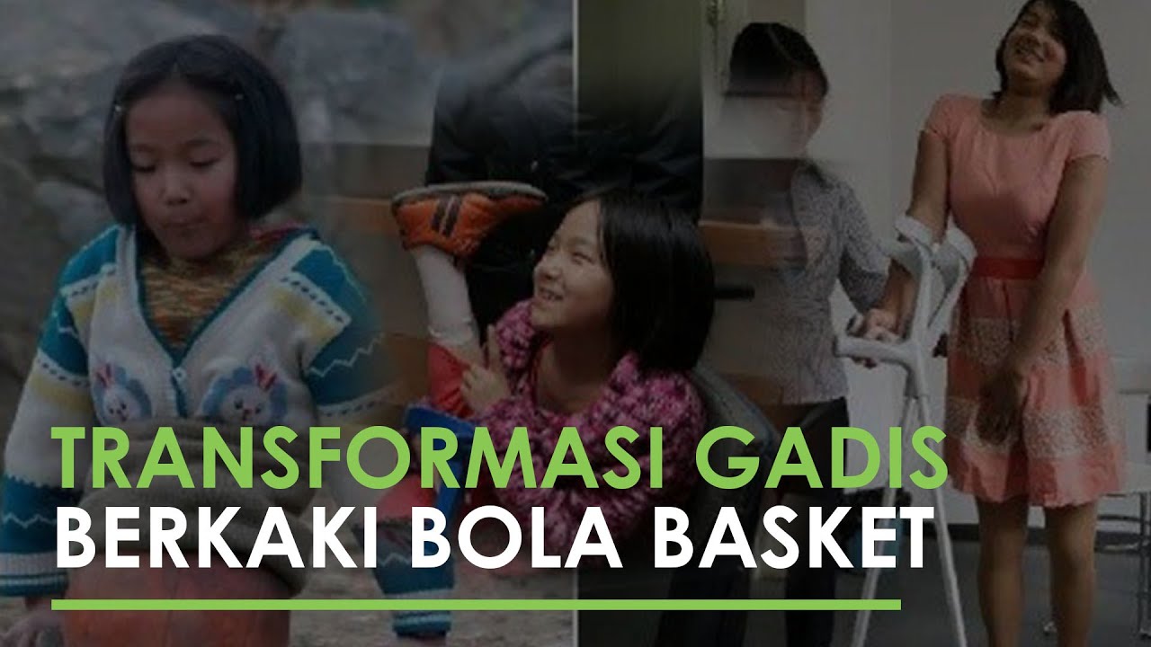 Transformasi Qian Hongyan Gadis Berkaki Bola Basket, Semakin Cantik dan ...