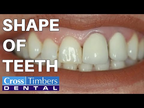 Shape of teeth: The Cosmetic Quadrant