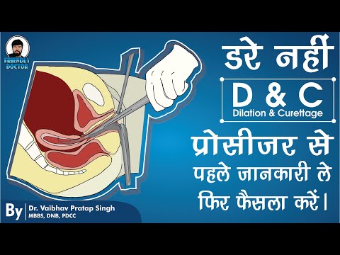D&C (Dilation and Curettage) in Hindi || Miscarriage || Abortion || Unwanted Pregnancy