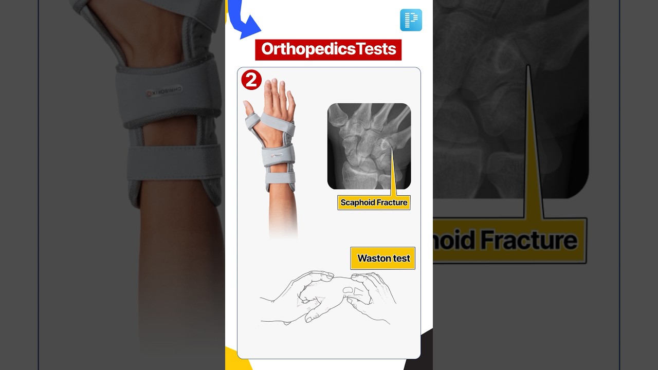 Must Know Tests In Orthopedics