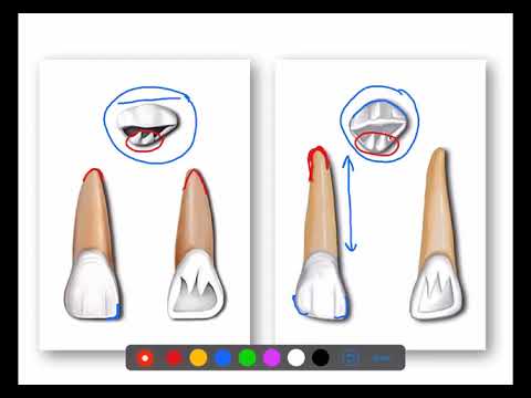 Permanent Teeth Part-1
