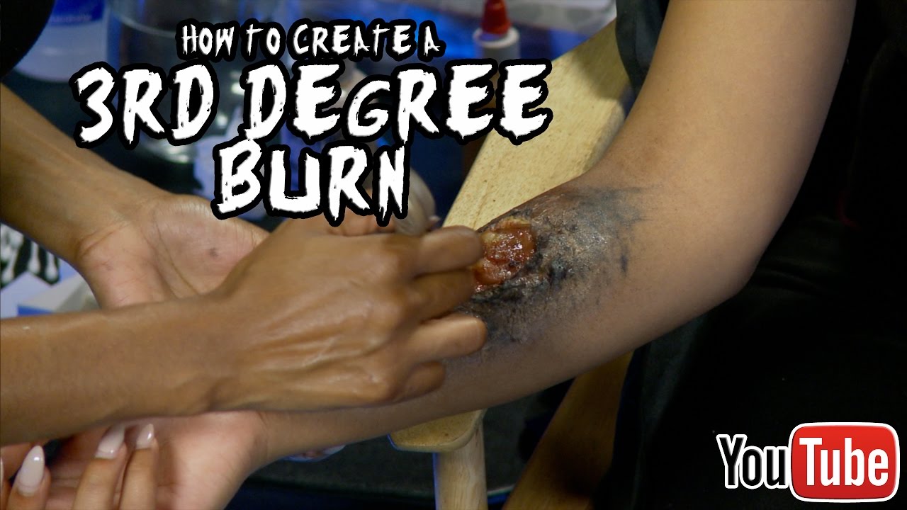 3rd Degree Burn Make Up Tutorial