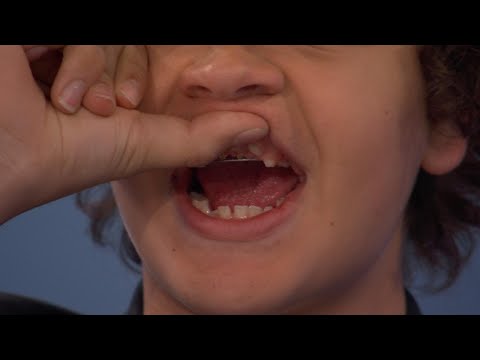 Does "Stranger Things"'s Gaten Matarazzo Have Cleidocranial Dysplasia ...