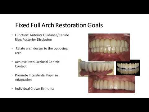 [Webinar] Removable Technology for the Fixed Technician with Allie Williamson, CDT, TE