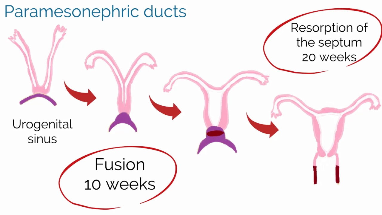 APGO Basic Sciences - Topic 20: Mullerian Anomalies