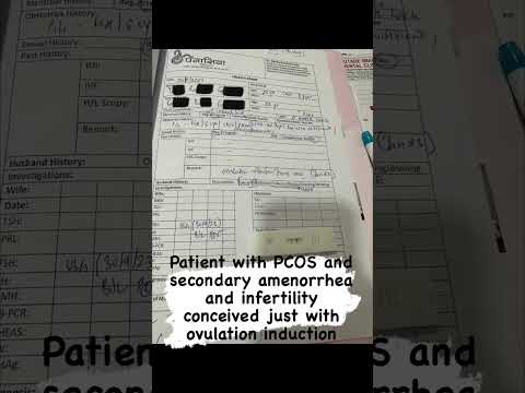 patient with pcos and secondary amnorrhea conceived just with ovulation induction
