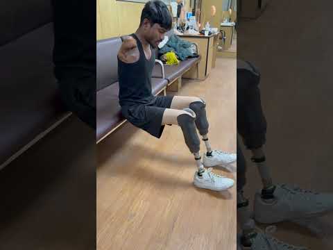 Below Knee Prosthesis Price | Artificial Leg Price | Ossur Foot | Carbon Foot| Nakli Tang | #ossur