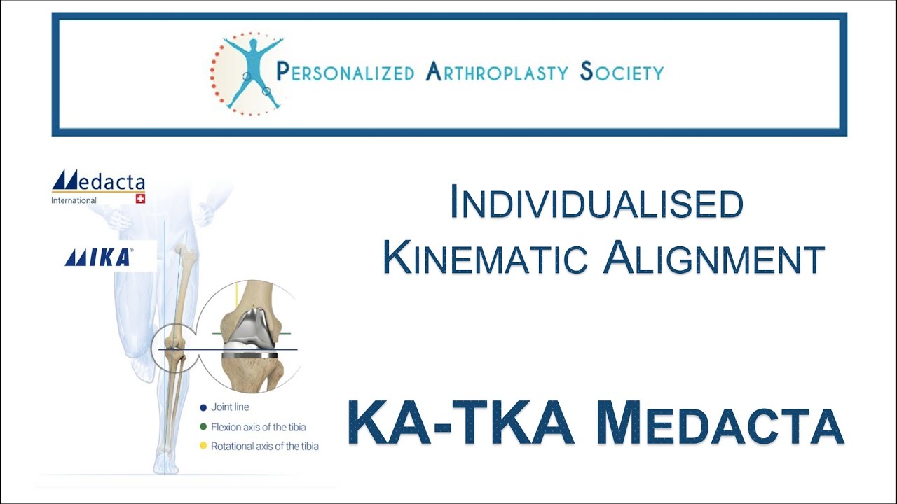 KA-TKA Medacta Individualised Kinematic Alignment