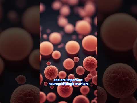 Pick's disease