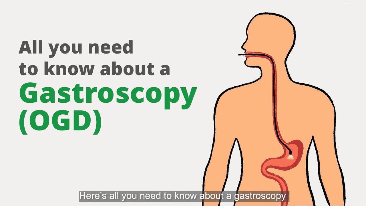 Gastroscopy (OGD): What is it for, and what should I expect?