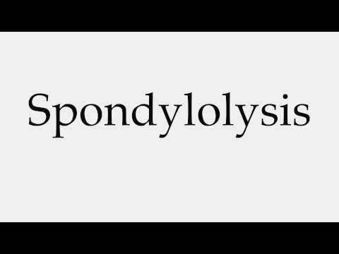 How to Pronounce Spondylolysis