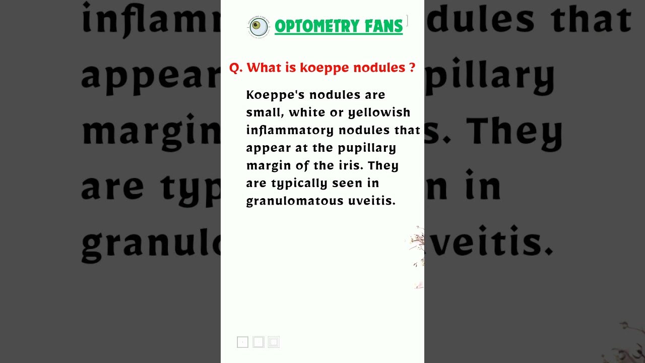 What is Koeppe's nodules ?