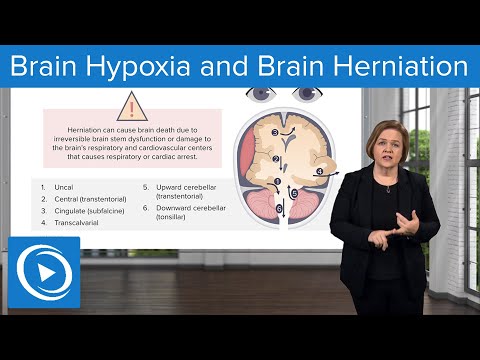 Brain Hypoxia and Brain Herniation – Med-Surg Nursing | Lecturio