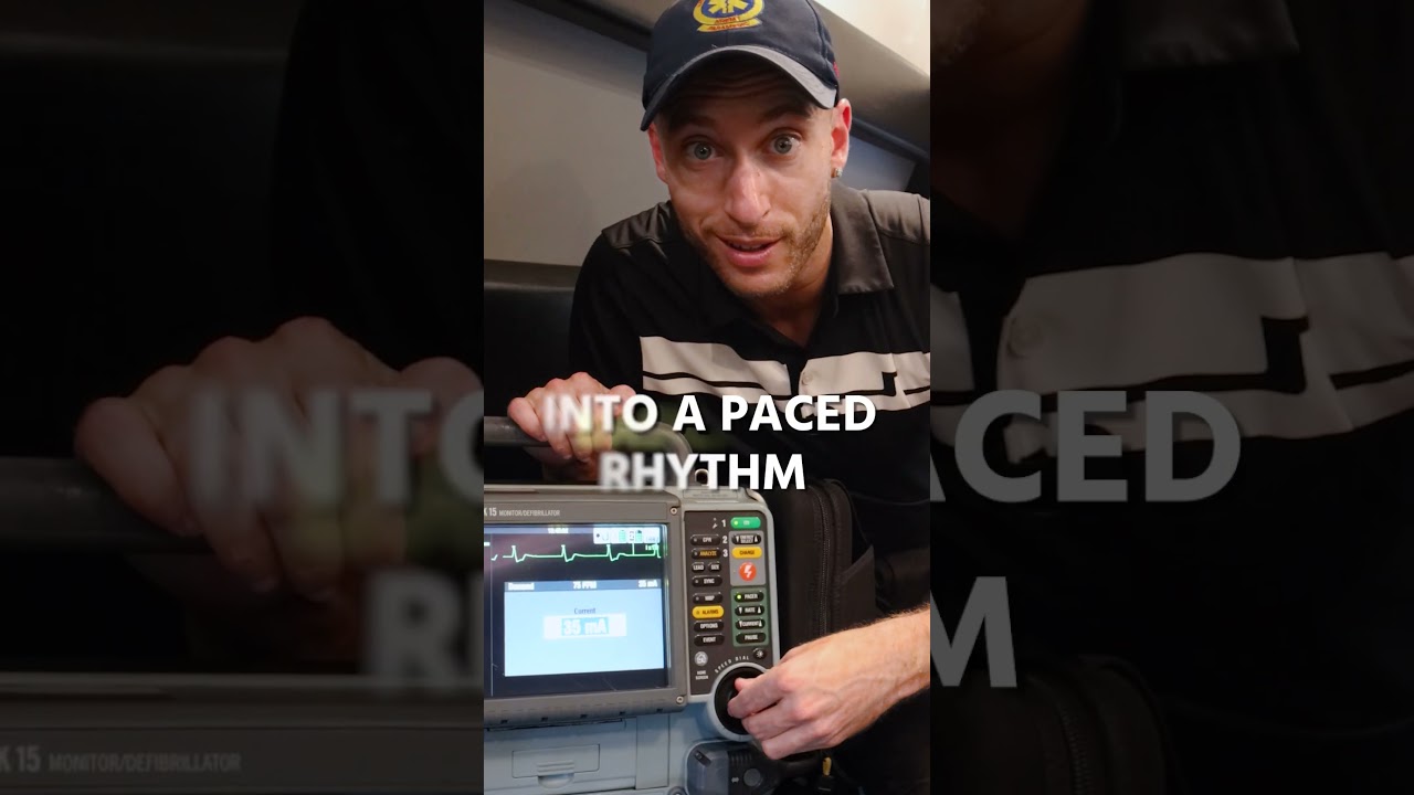Pacing a Complete Heart Block