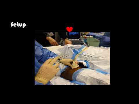 Introduction to US Guided Nerve Blocks Part III
