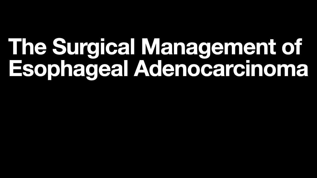 The Surgical Management of Esophageal Cancer