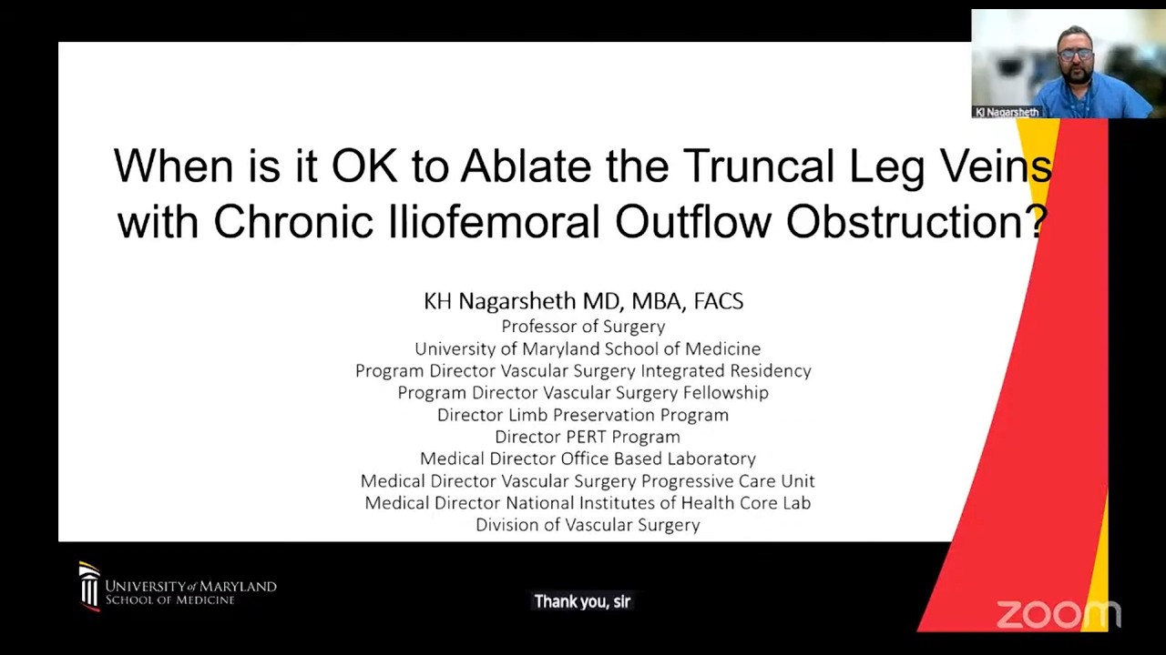 Can we ablate the saphenous vein in the presence of chronic iliofemoral outflow obstruction?
