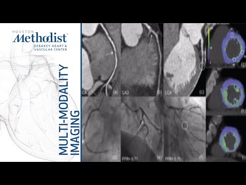 CTA for Assessment of Coronary Anatomy and Physiology (Su Min Chang, MD) December 3, 2019