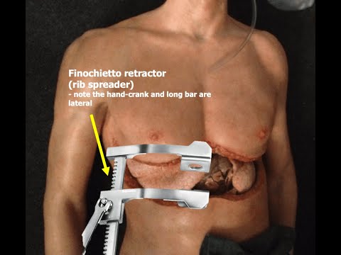 CPT code for Thoracotomy - simplify medical coding