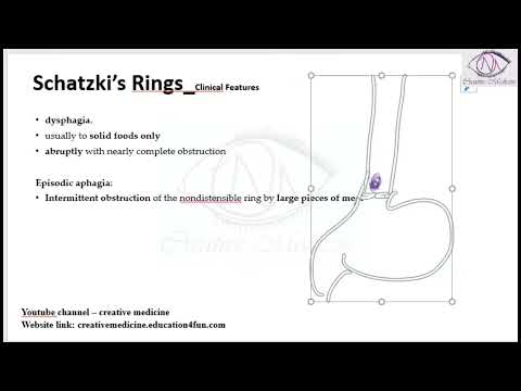Lec 3 Schatzki’s Rings Diagnosis mp4