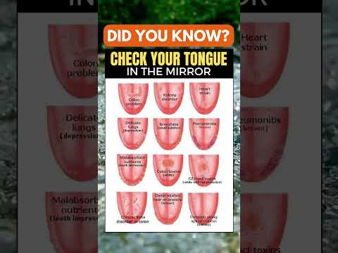 Tongue Diagnosis