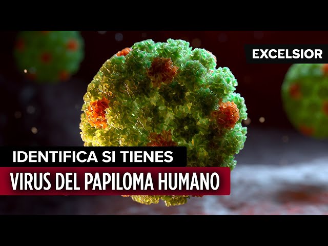 10 Cosas Del Virus Papiloma Humano Vph Que Debes Saber