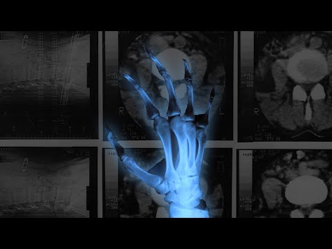 6 Amazing Facts About X-Rays!