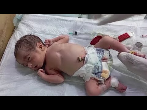 Total iv canulaation just in 20 seconds watch and learn