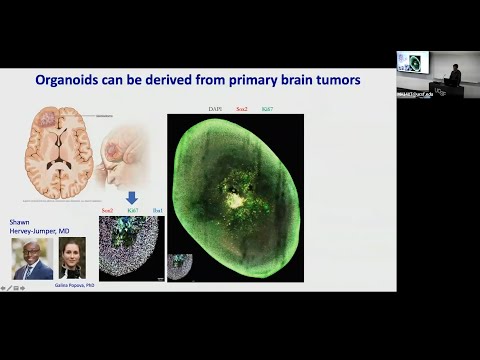 Establishing Pre-Clinical Models for Human Neurological Disorders | Tom Nowakowski, PhD