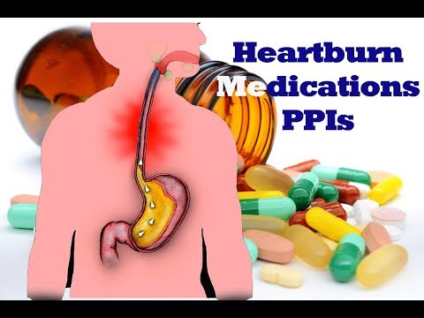 PPIs for Heartburn: Forever?
