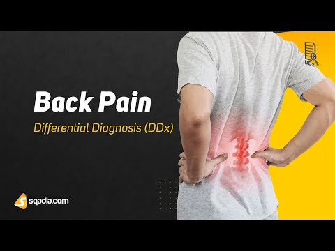 Back Pain Differential Diagnosis | DDx