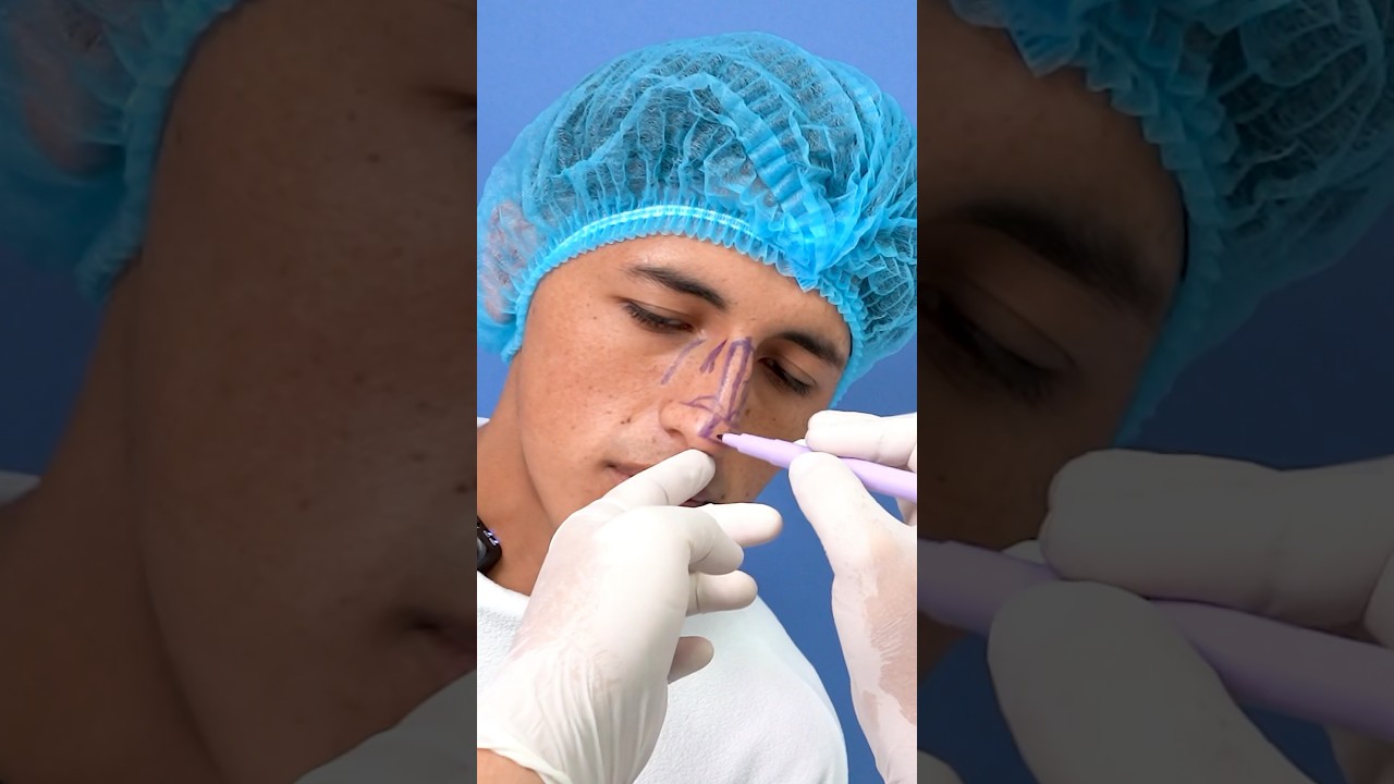 How about this? We've improved the nasal bridge and tip to give it harmony and symmetry.