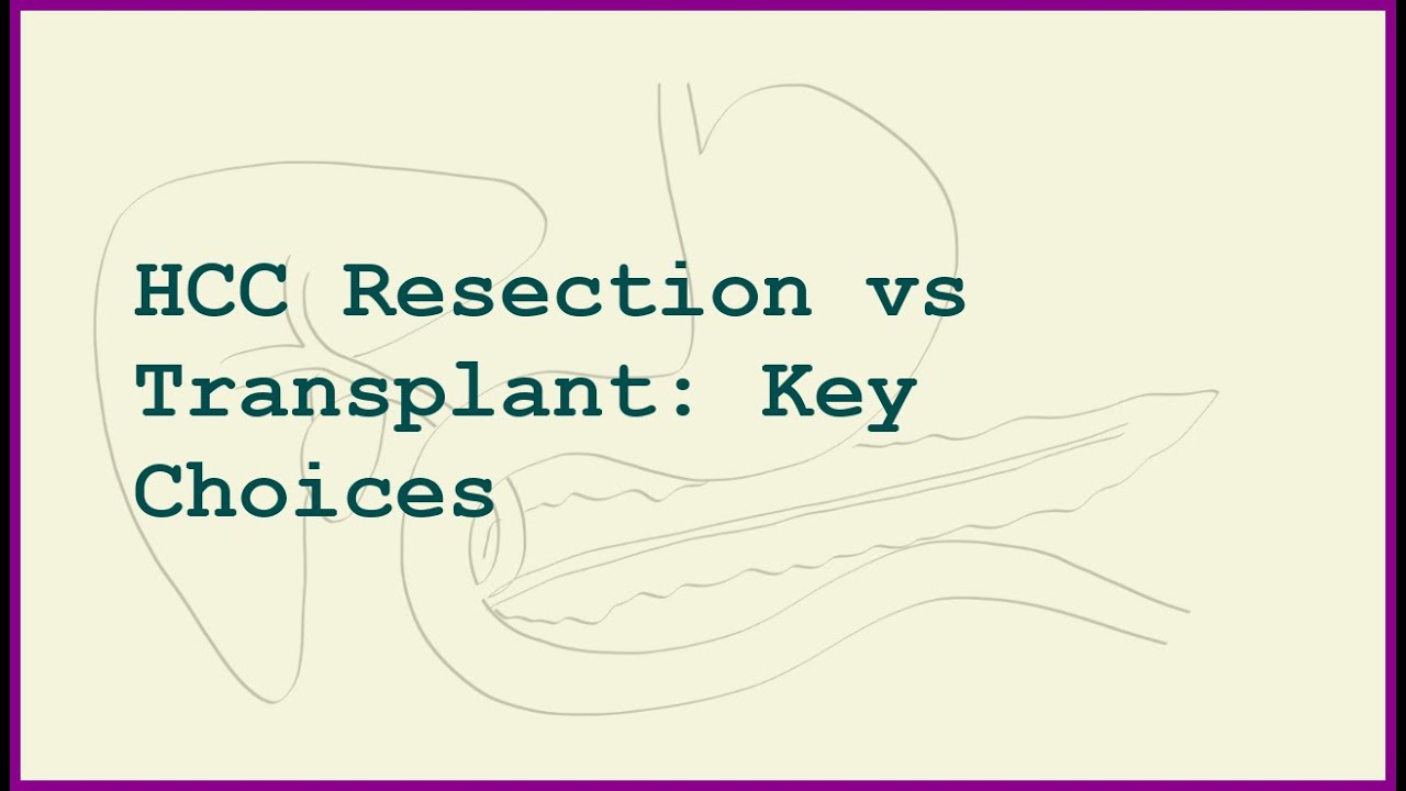 HCC Surgery: Resection vs Liver Transplant
